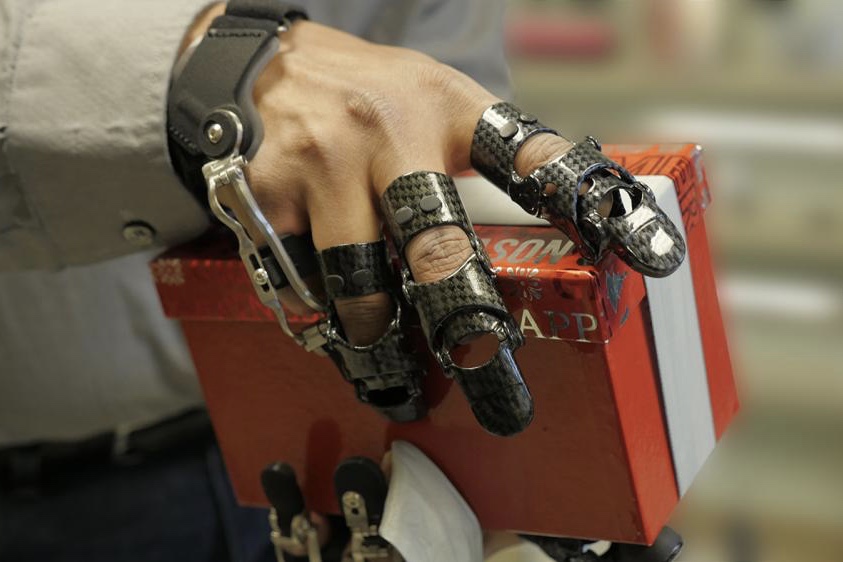 How These Prosthetics Can Make Life Easier...